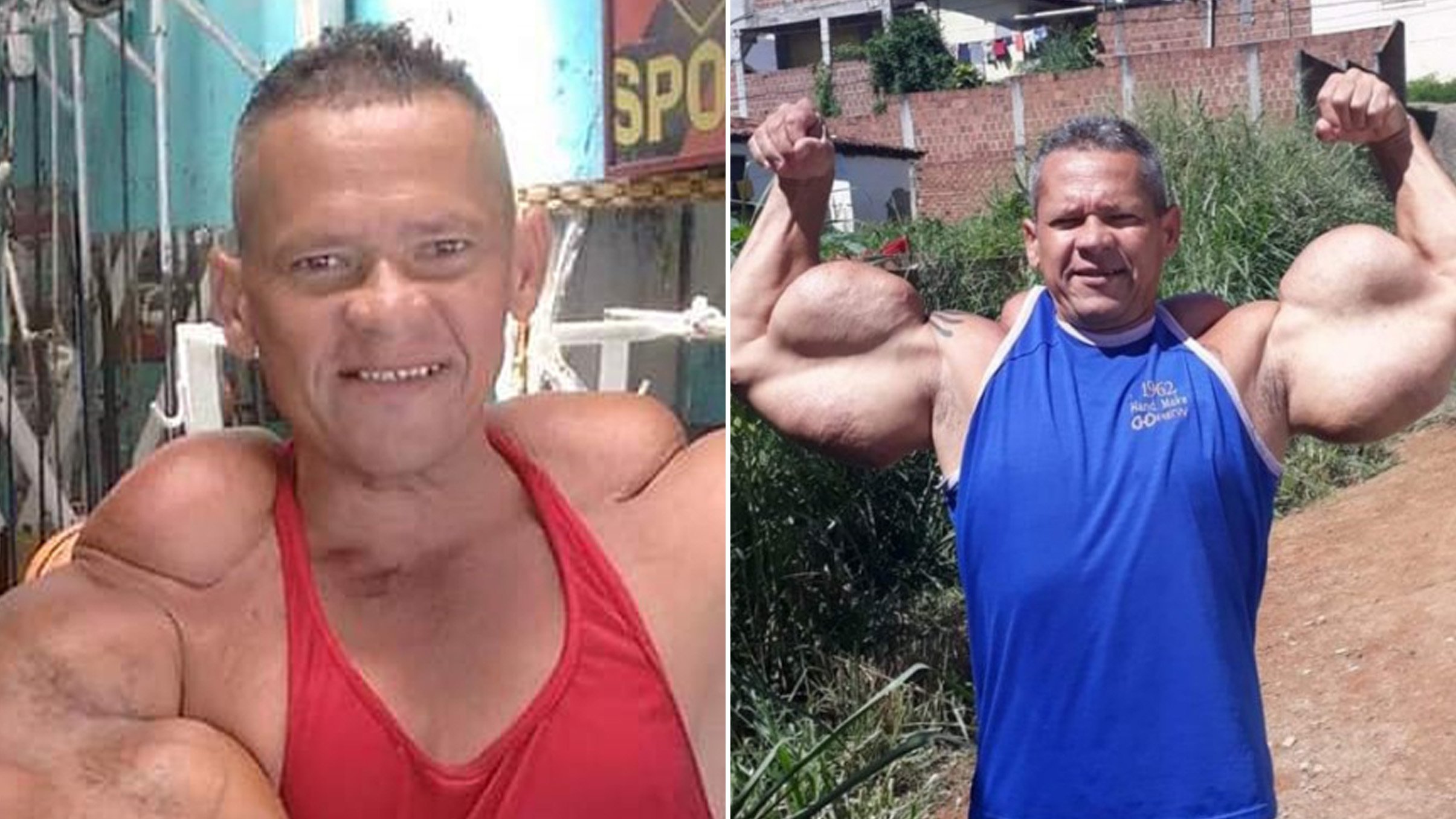 Brazilian 'real-life Popeye' dies at 55