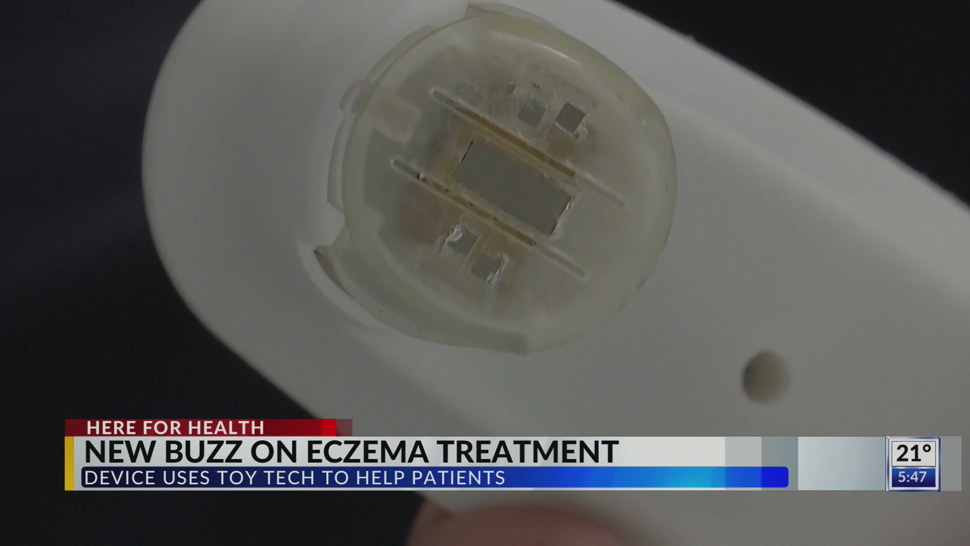 Here for health: New buzz on eczema treatment