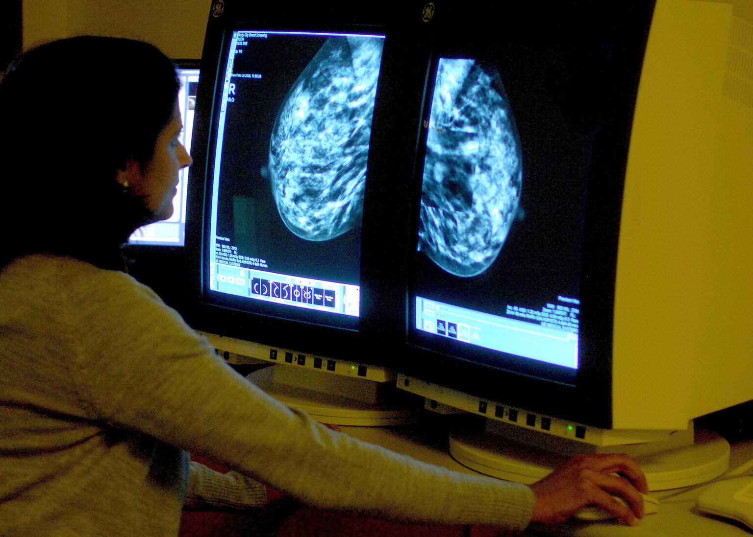 Just 3.5% of urgent NI breast cancer referrals seen within 14-day target