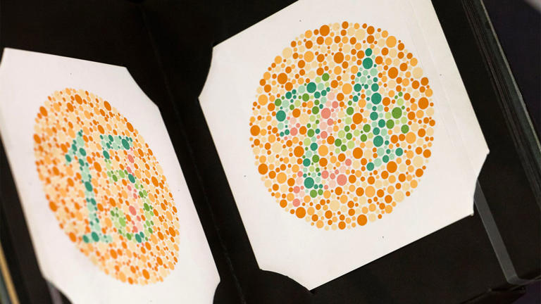 Color blindness and bladder cancer: A bad combination for survival?