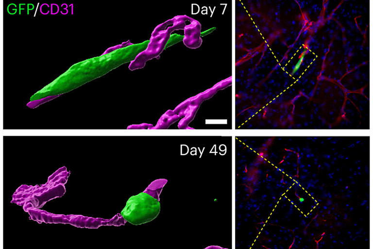 Dormant cancer cells can change shape to survive immune system attack