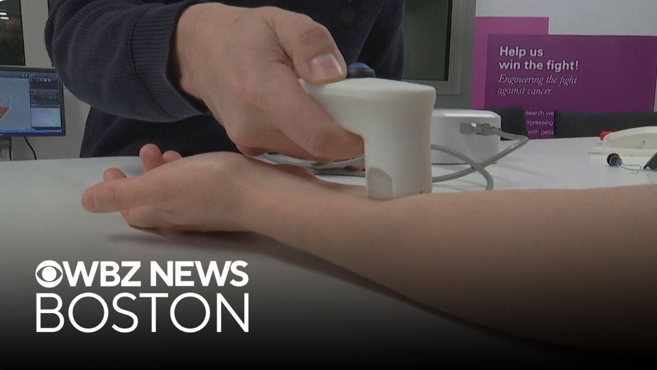 Doctors in Scotland may have found new way to treat eczema