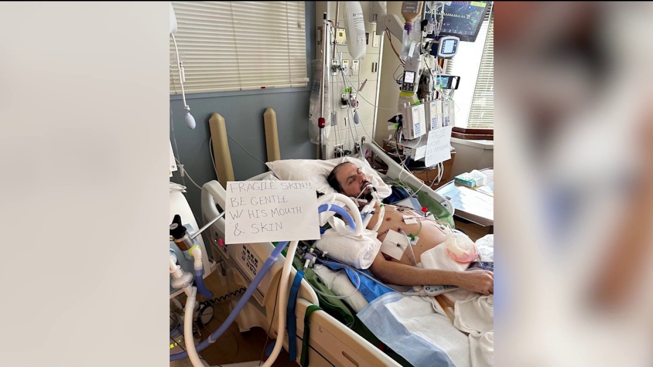 Woodbury man with rare skin condition released by ICE