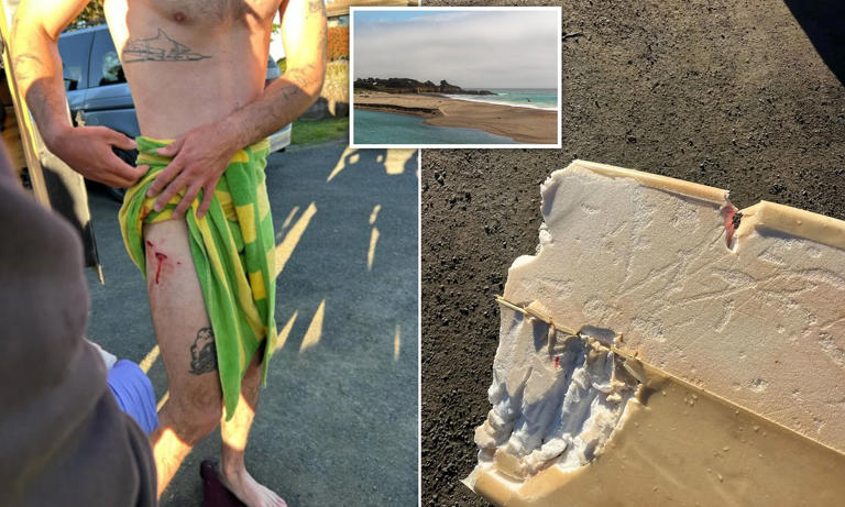 Surfer describes perilous shark bite as his board is snapped in half ...