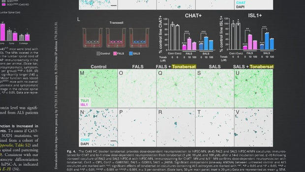 Final wish denied as Colorado ALS patient's access to experimental drug ...