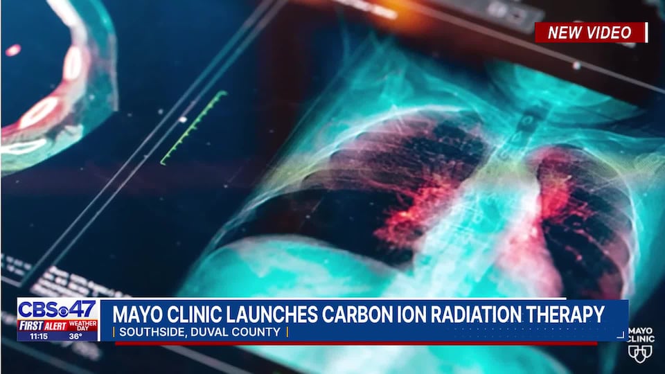 Gov. DeSantis, Mayo Clinic announce first US carbon ion therapy program ...