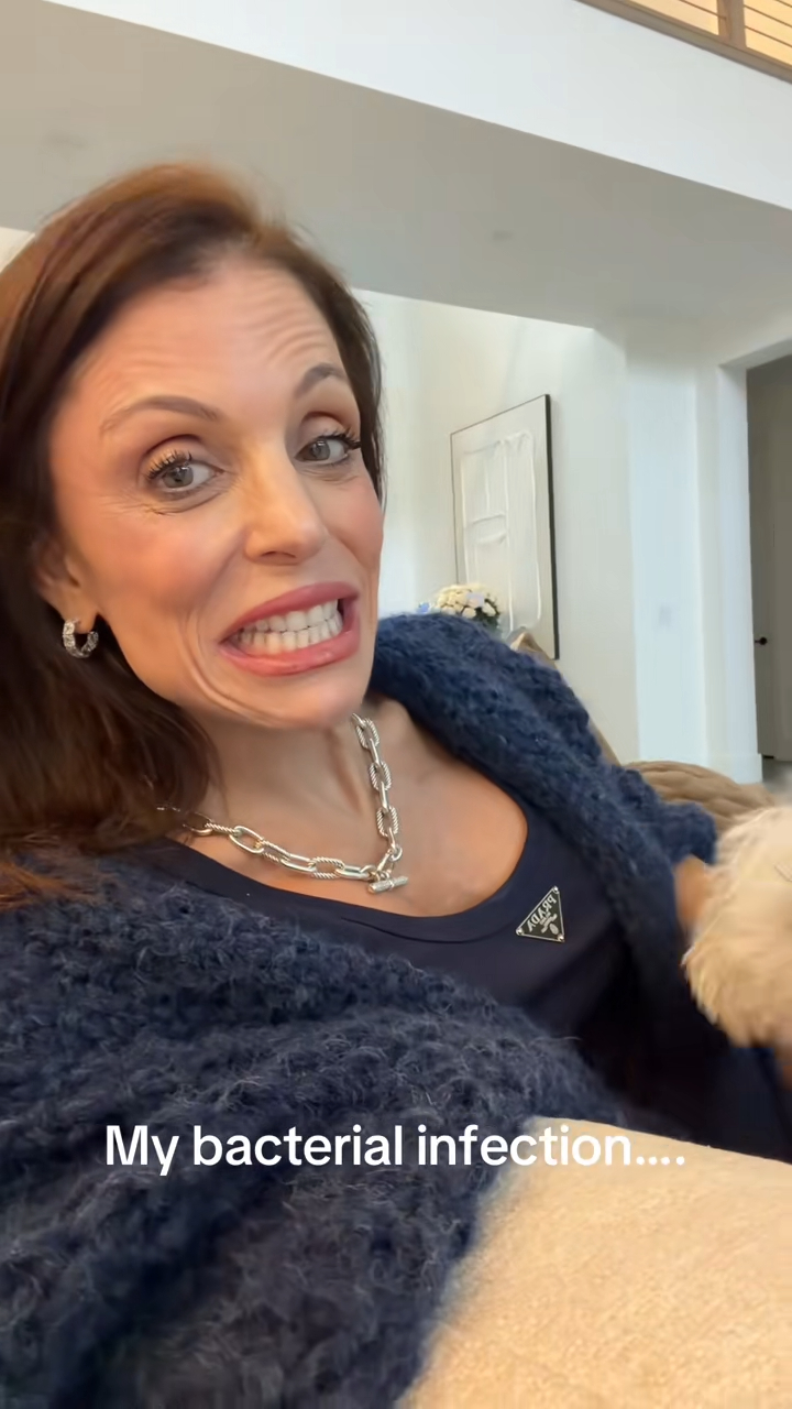 Bethenny Frankel says this common item is to blame for her facial ...