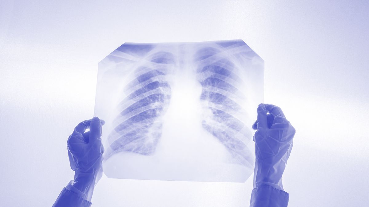 4DMedical completes $150m institutional placement