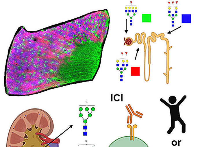 Sugar structures on kidney cells predict immune therapy response, study ...