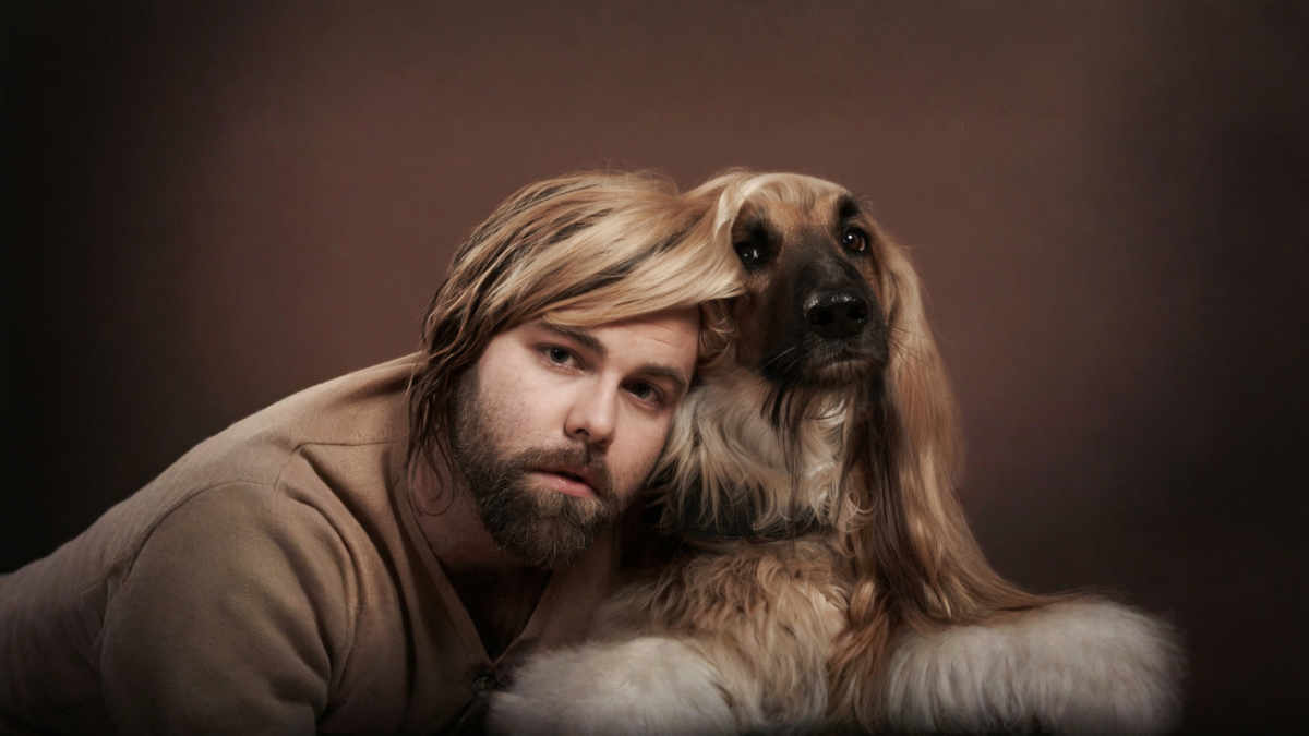 Is modern life making men go bald early?