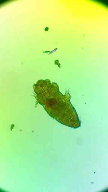 I Found One Of The Worlds Smallest Animal In My Backyard! - Microscope