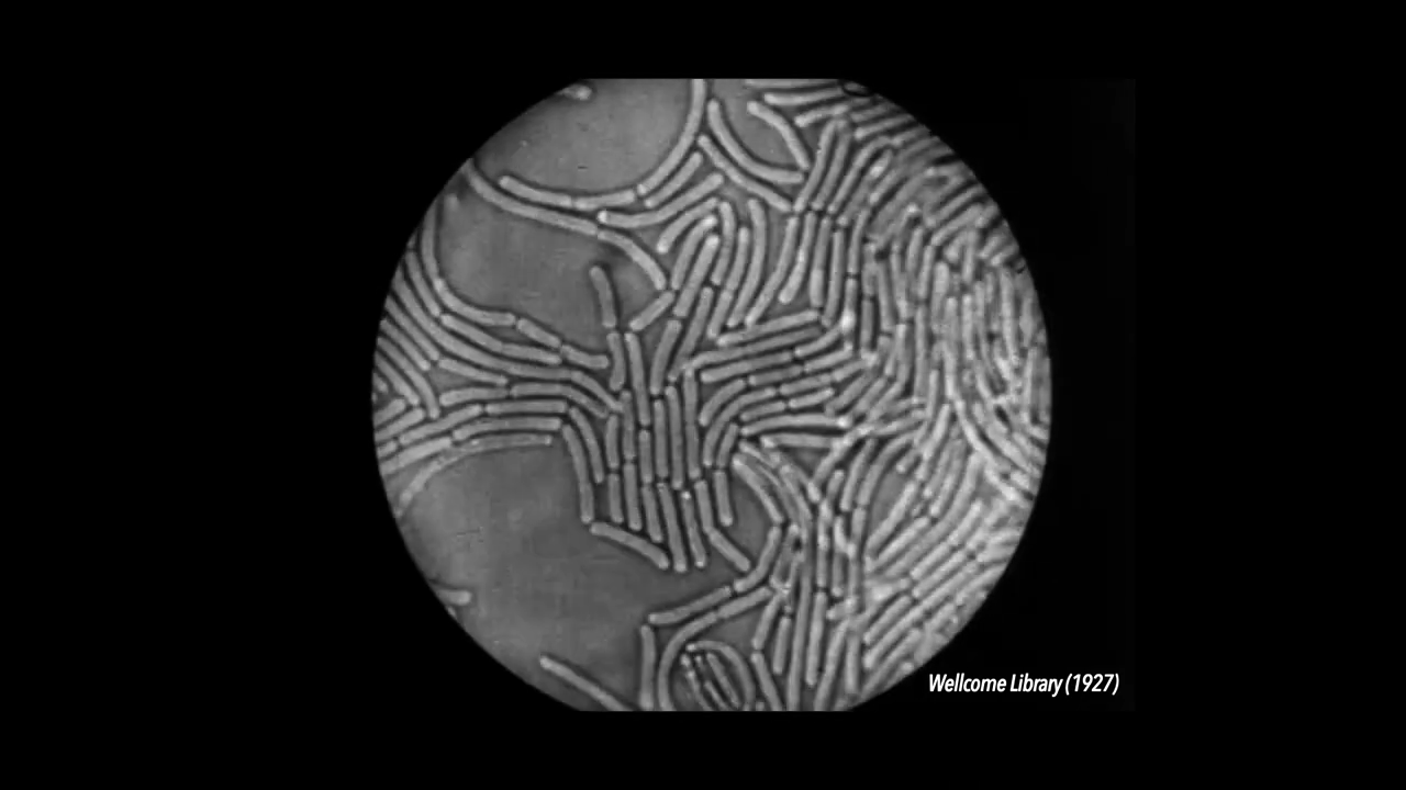 Why modern food systems spread bacteria