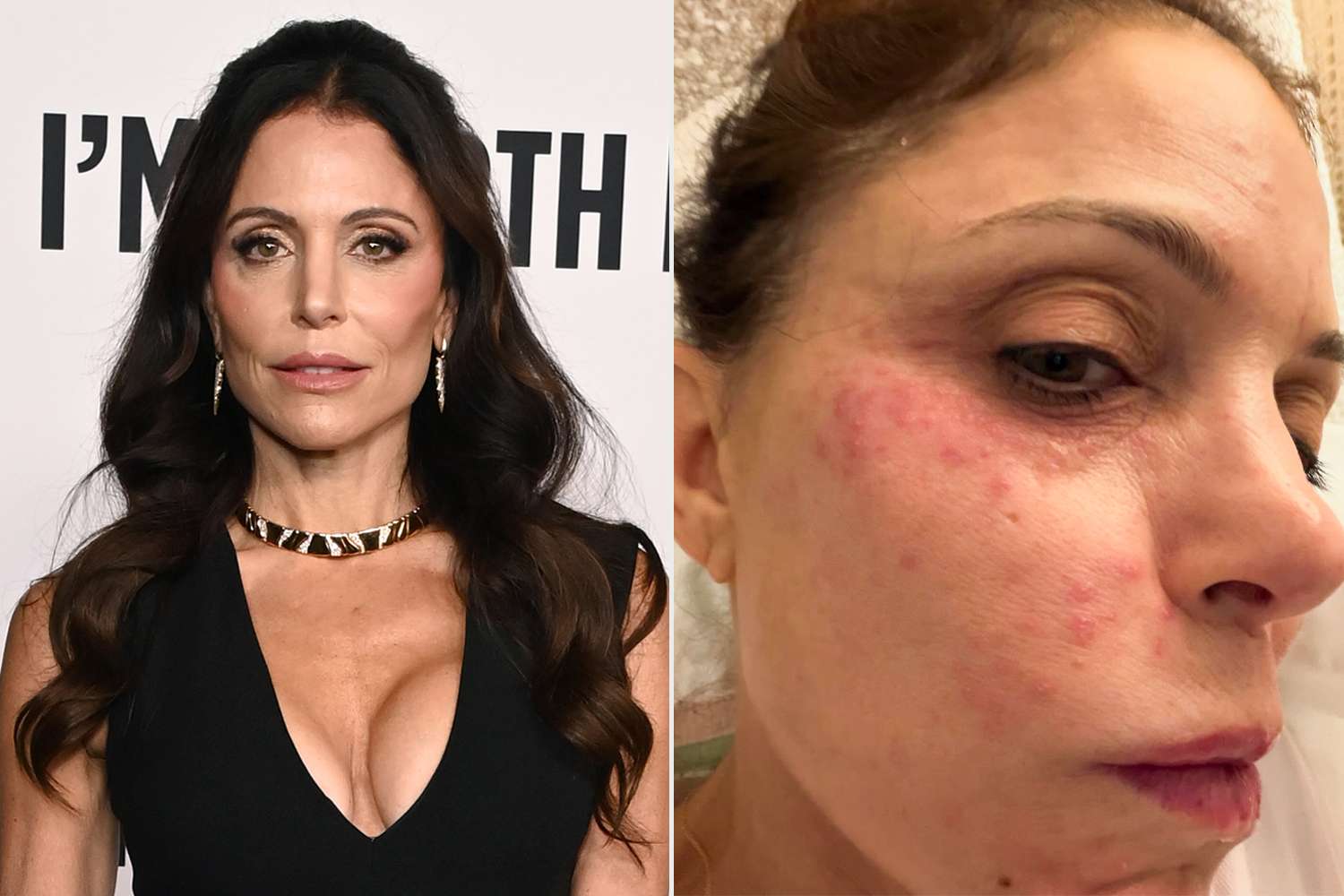 Bethenny Frankel says she will never use a hotel towel or sheet again ...