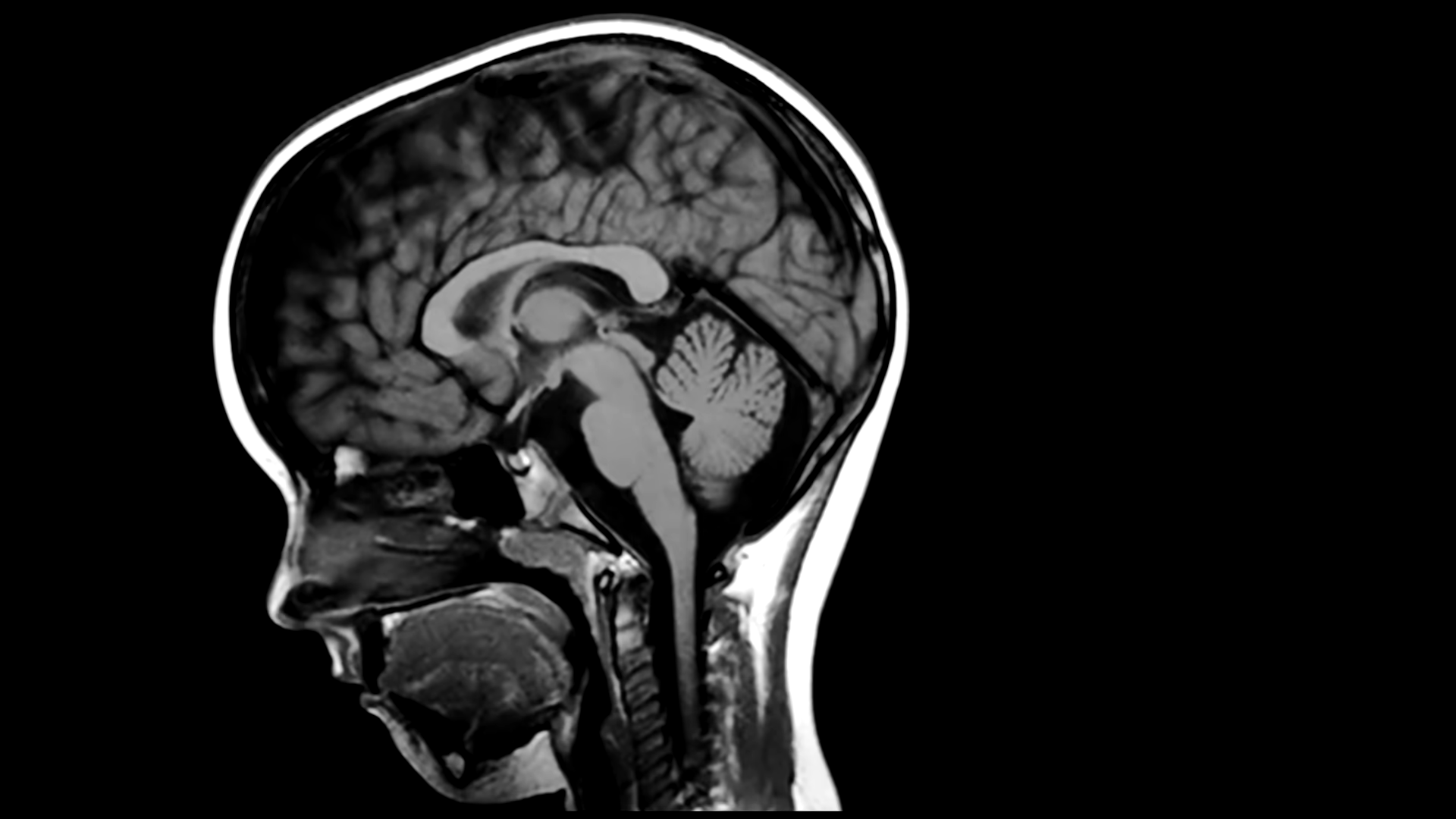 This is what scientists just discovered inside the human mind