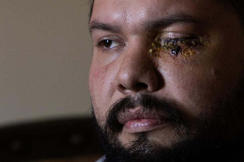 Second man shares horrific story of being blinded by officers at anti ...