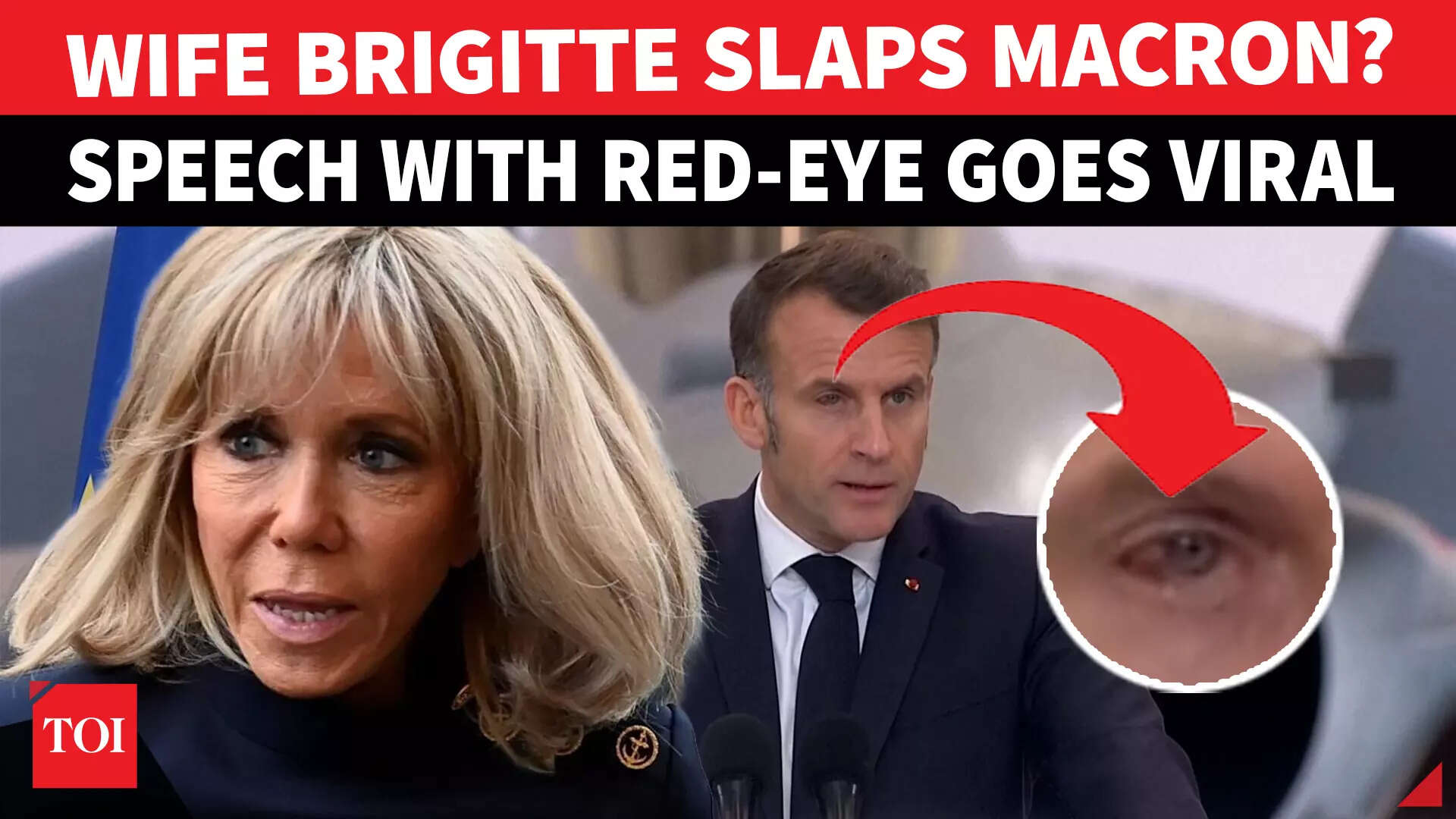 Macron Appears With Red Eye; Rumours Mill In Overdrive; Another Bloody ...