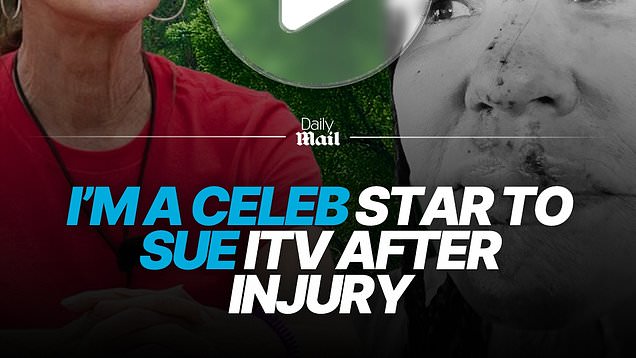 Janice Dickinson considers suing ITV over injury sustained on I'm a ...