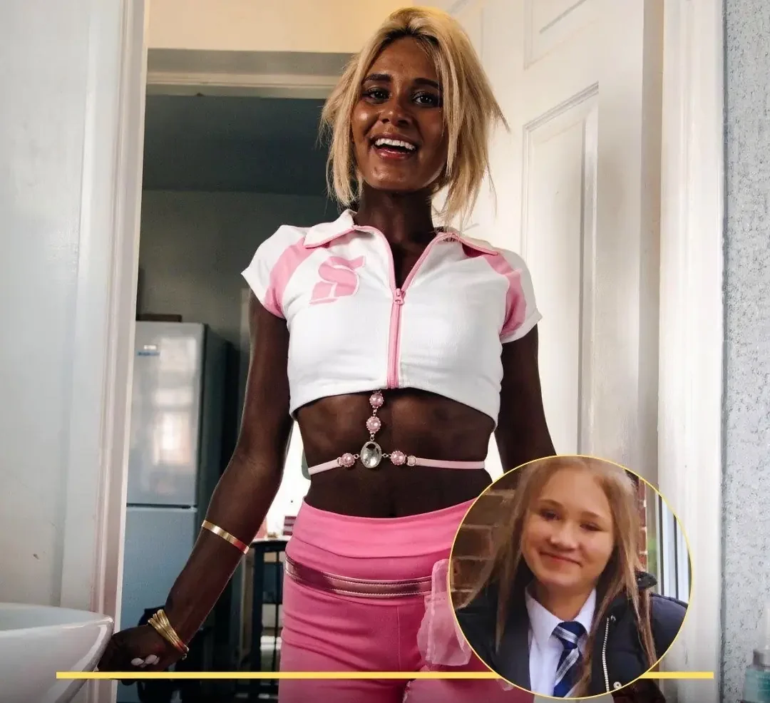 Adicción al bronceado: joven no logra detenerse pese al miedo al cáncer