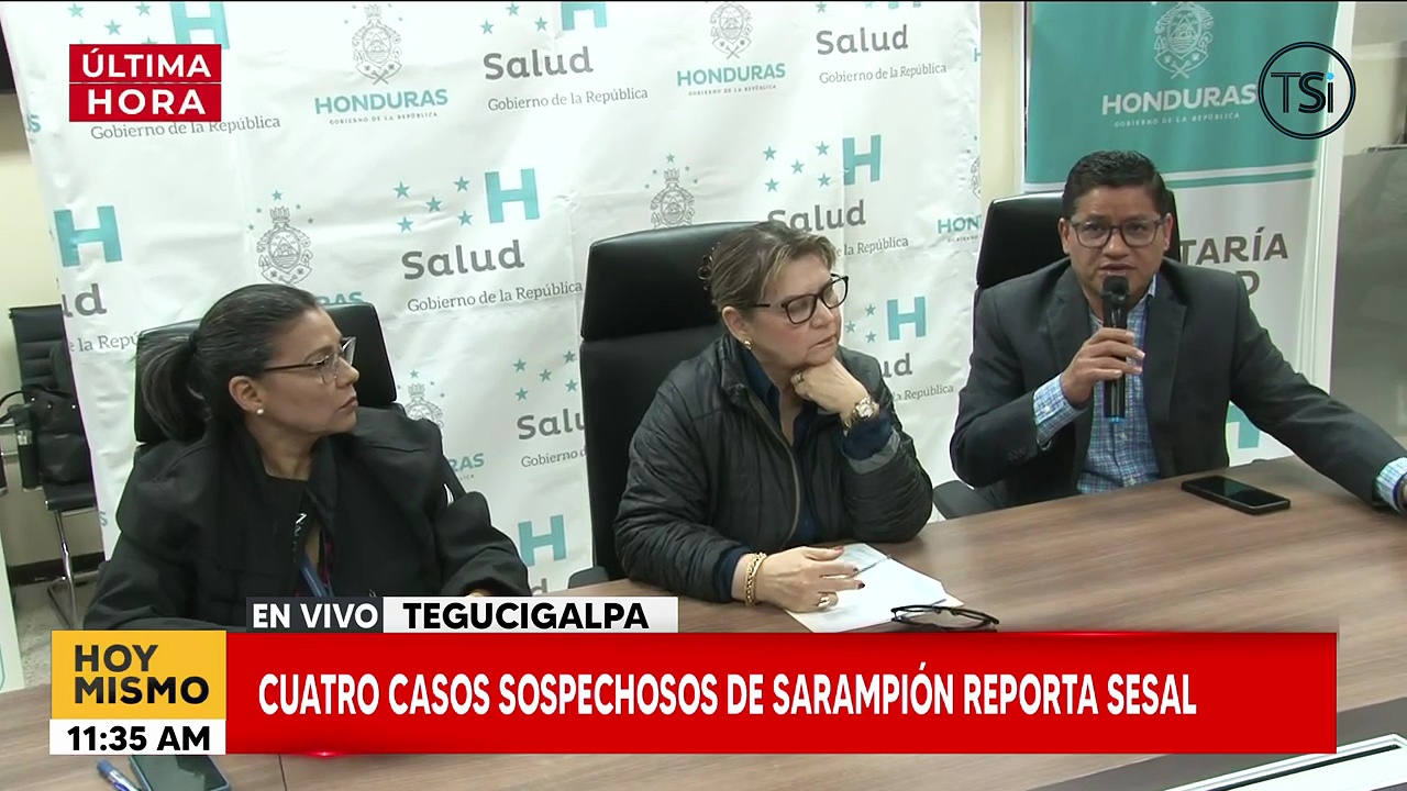 Salud de Honduras reporta cuatro casos sospechosos de sarampión