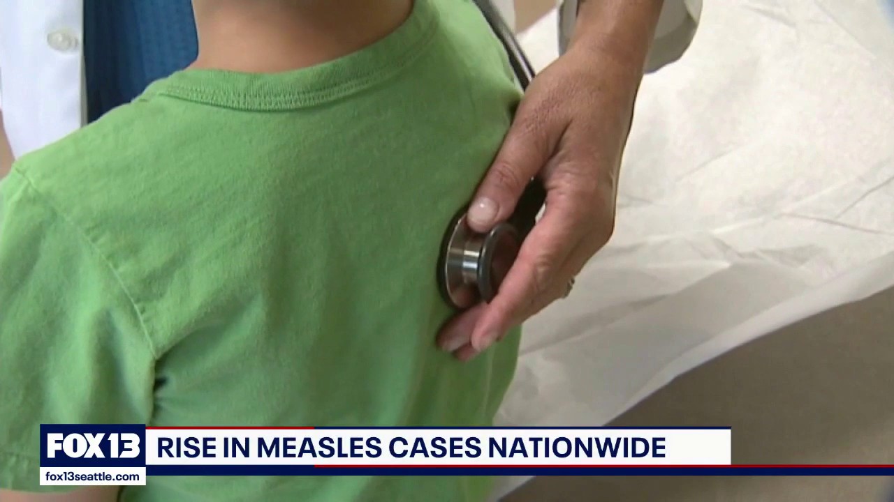 Snohomish County declares measles outbreak after three children test ...