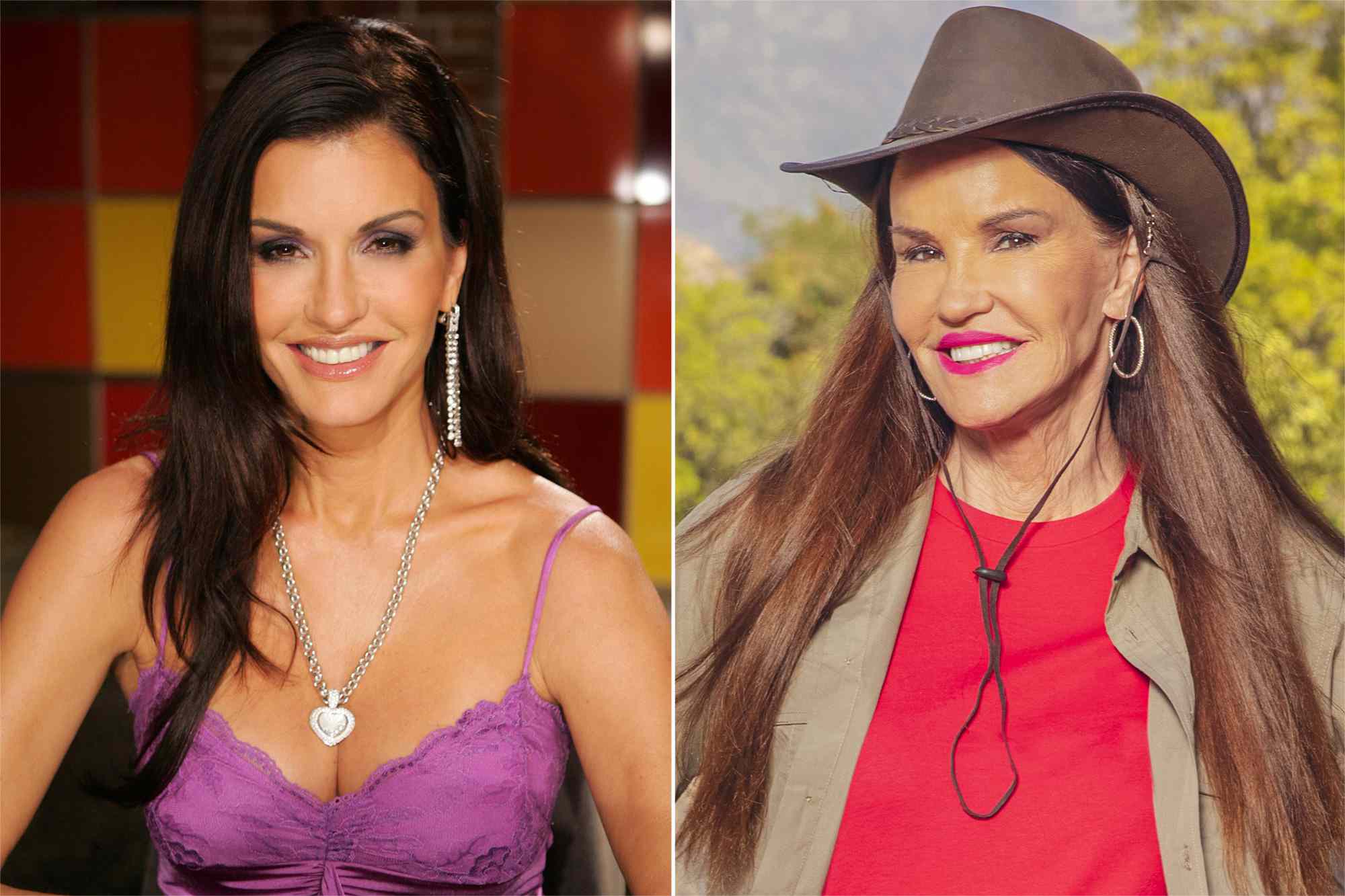 ANTM alum Janice Dickinson claims face is permanently scarred after ...