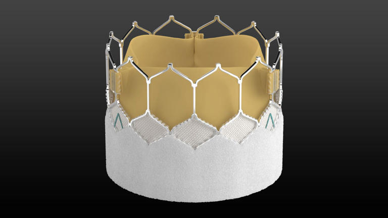 Hemolysis a growing concern with newer Sapien TAVR device