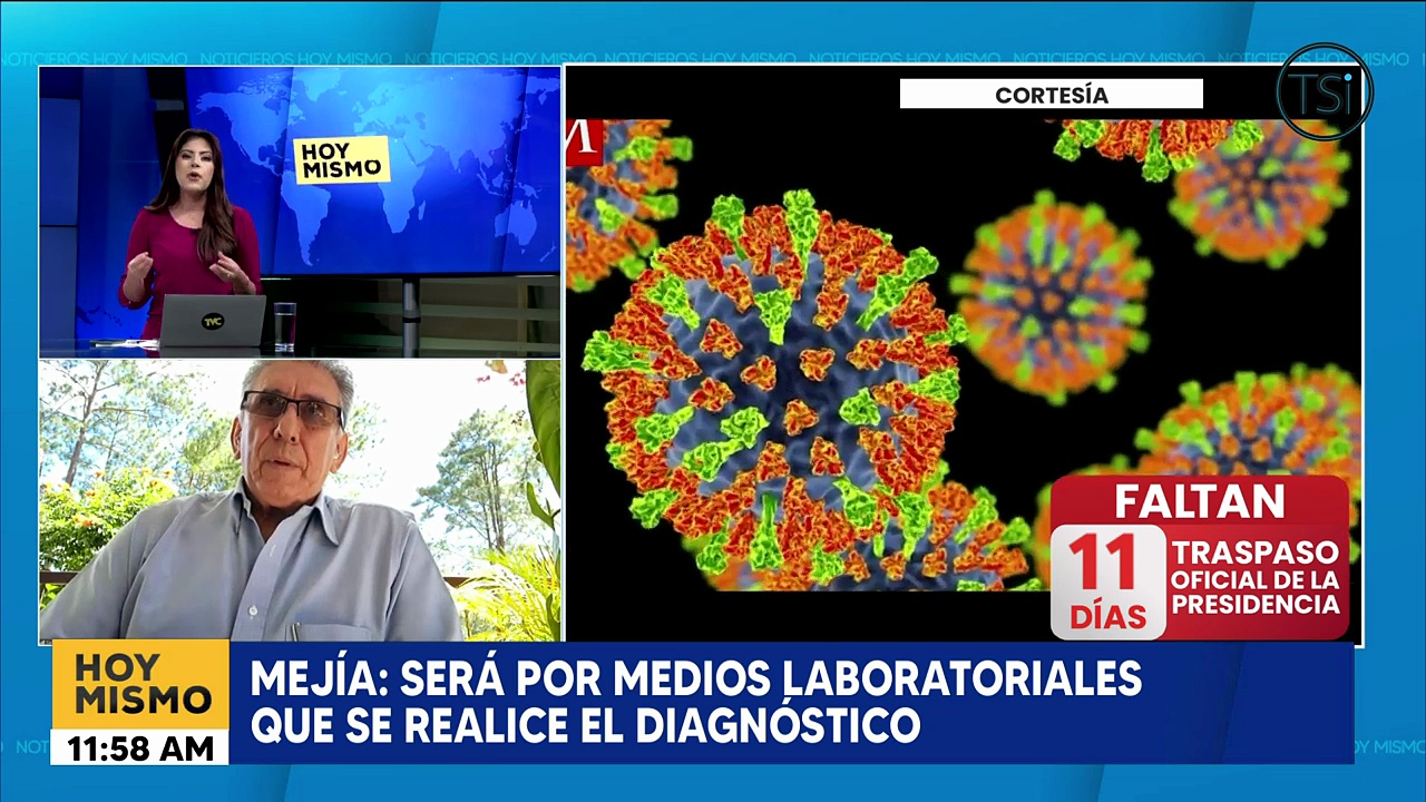 Epidemiólogo hondureño explica los síntomas del sarampión