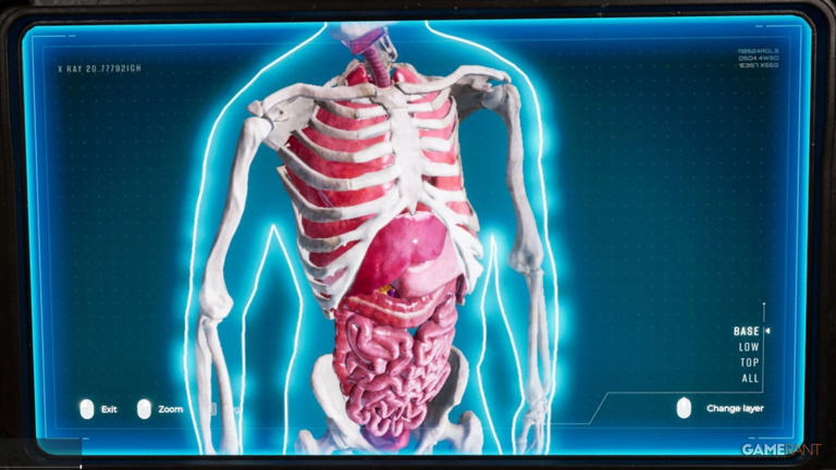 How to Use the X-Ray in Quarantine Zone The Last Check