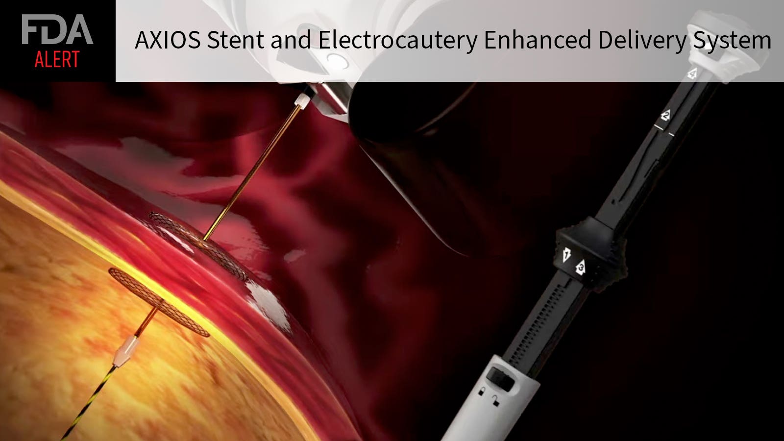 FDA flags Boston Scientific device tied to 3 deaths, scores of injuries