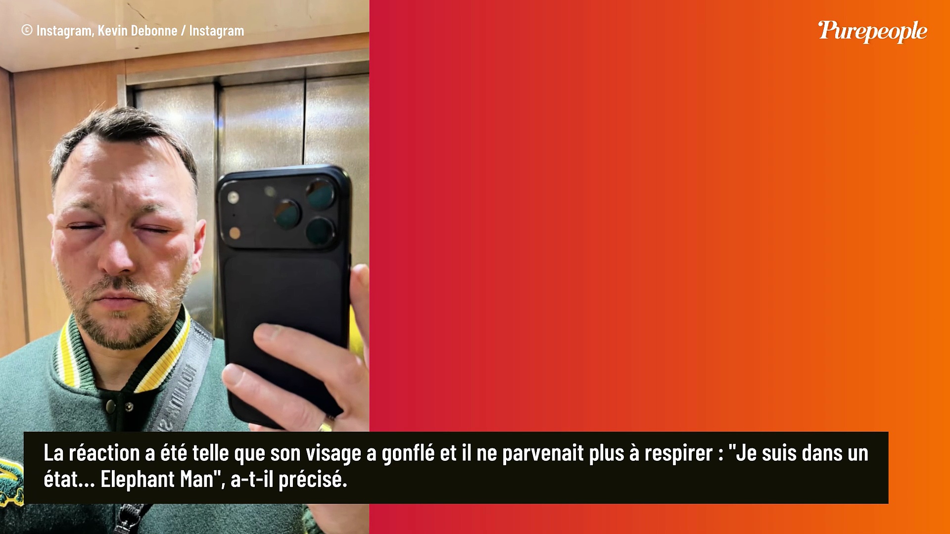 Kevin Debonne : L’ex-mari d’Inès Reg pris d'une grande allergie, il ...