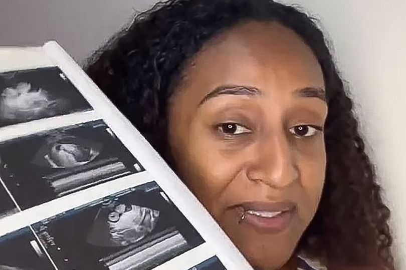 Mum, 24, conceived miracle second baby whilst already pregnant in ultra ...