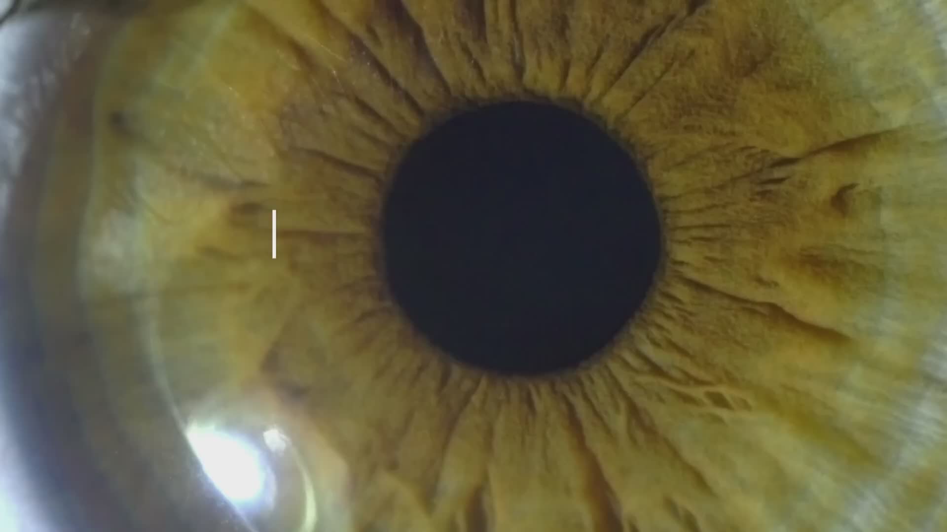 Red flags in vision changes