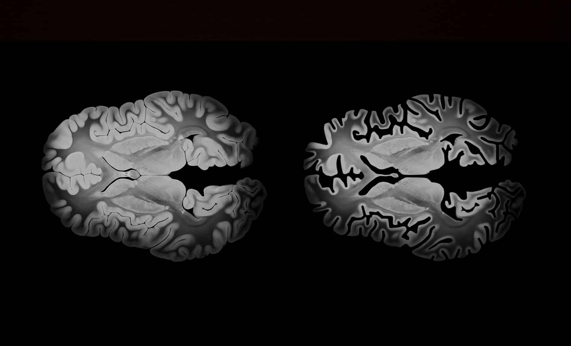 Scientists just found out why your brain suddenly starts forgetting things