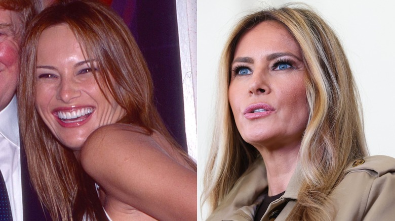 Political ladies who look totally different without rumored fillers