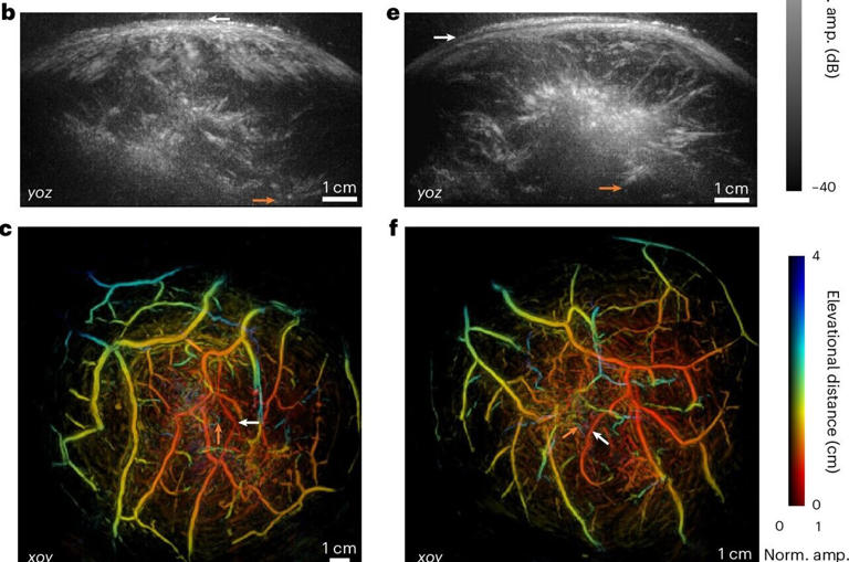3D hybrid imaging system could address limitations of MRI, CT and ...