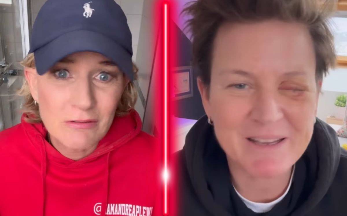 Presentadora de televisión Andrea Plewig pierde un ojo tras manipular ...