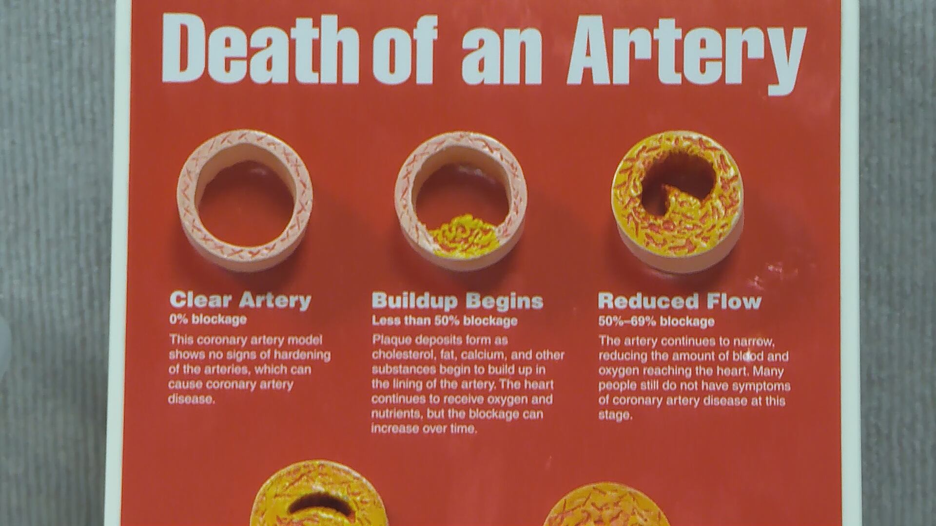 Berkeley County Library and SCDPH partner for heart disease prevention ...