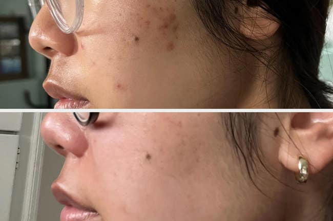 Let us be glad that reviewers did not gatekeep these 28 effective ...