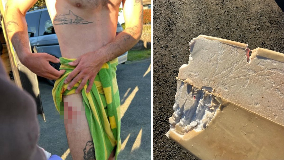 Surfer survives shark attack, board takes the hit