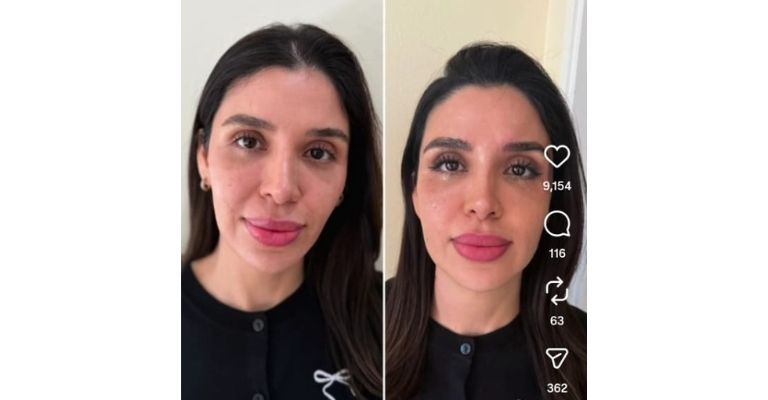 Emma Coronel se hizo un nuevo procedimiento estético, así luce ahora la ...