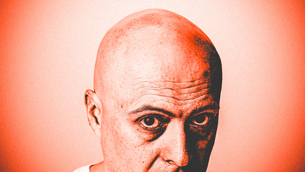 A subreddit dedicated to the bald community may be the most wholesome ...