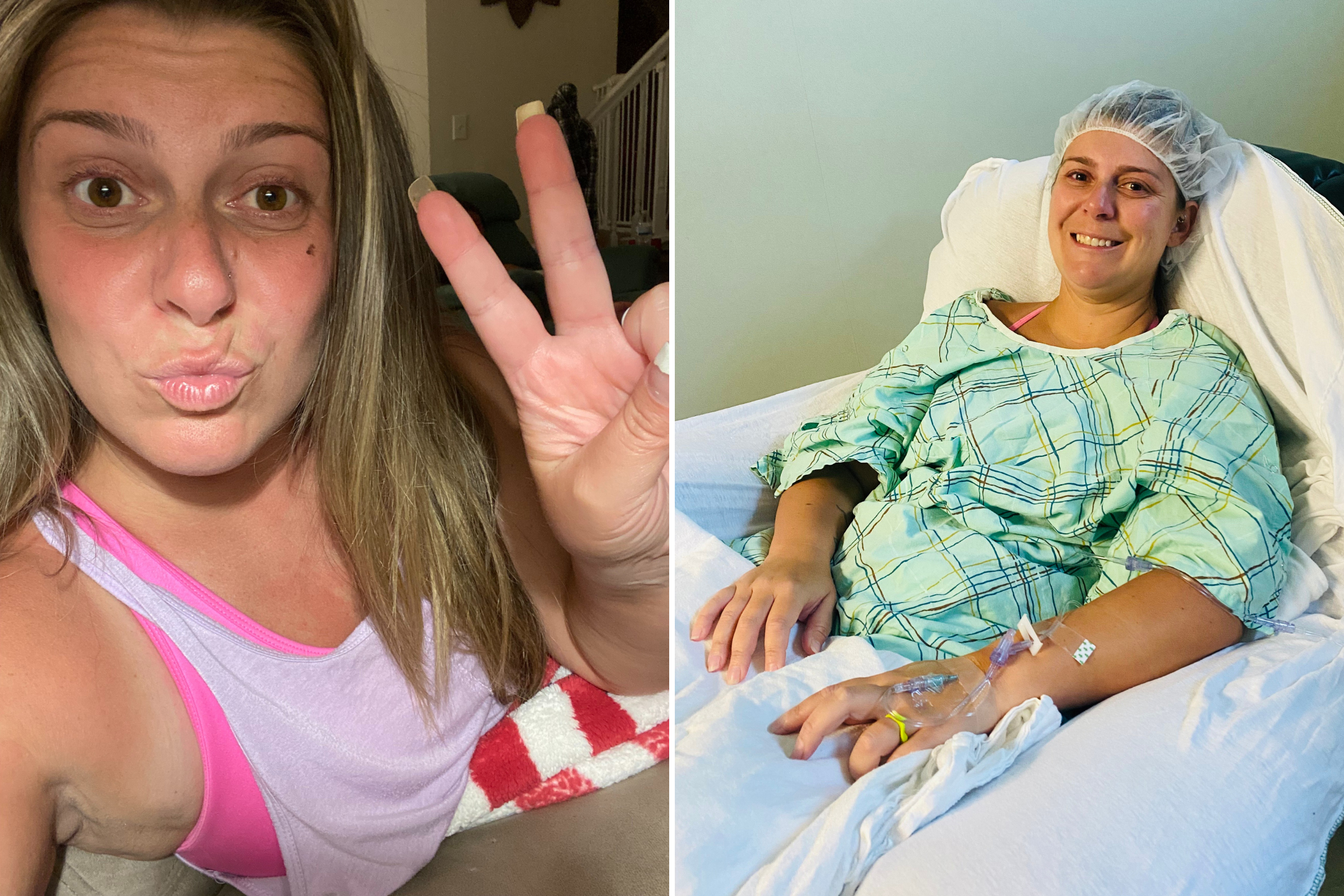 Mom has weird birthmark on face, test reveals shock diagnosis