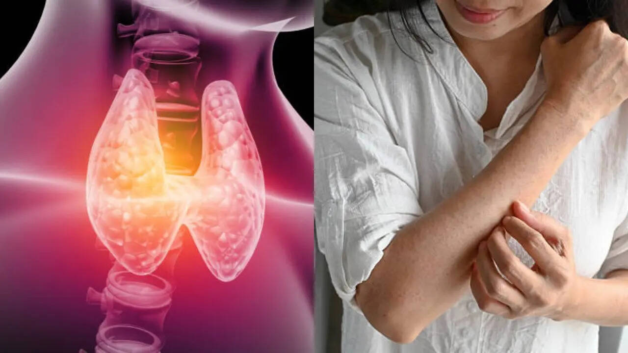 Hypothyroidism warning: Skin changes that shouldn’t be ignored