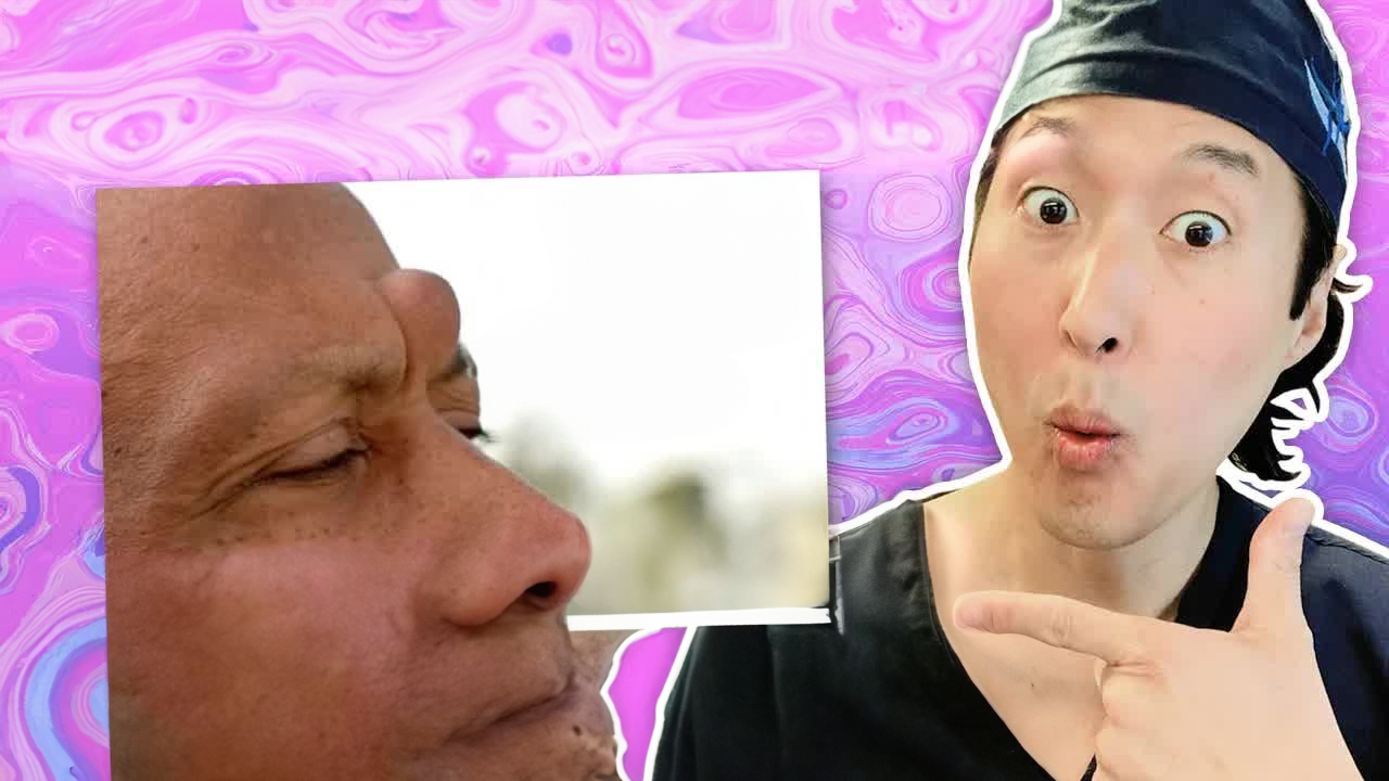 Plastic surgeon reacts to cyclops third eye case