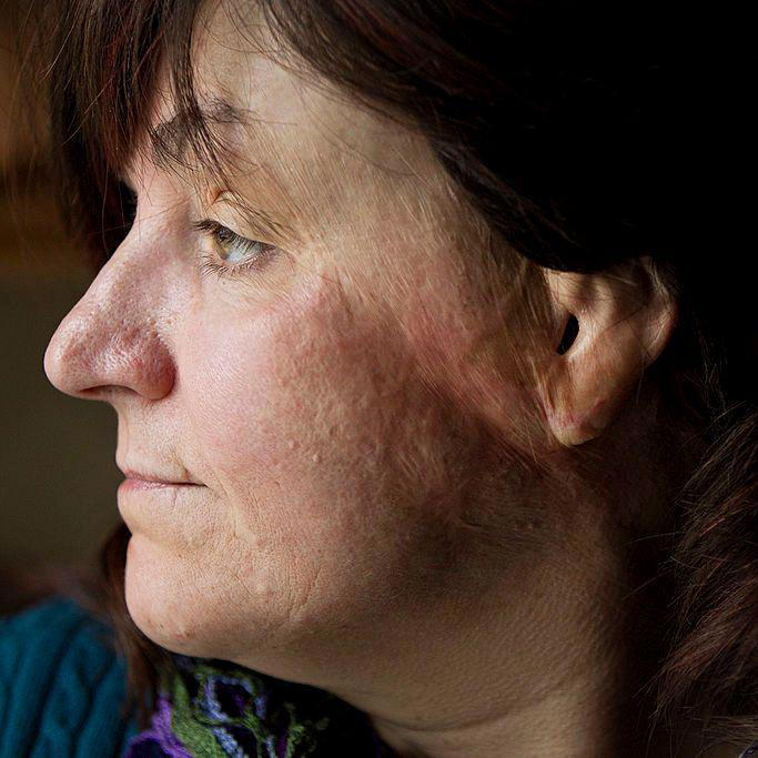 A deadly fire swept through a nightclub in just 90 seconds. I got out ...