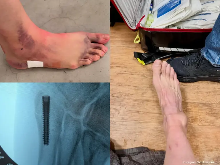 ‘Normal life is more complicated’: Wout van Aert clarifies injury after ...