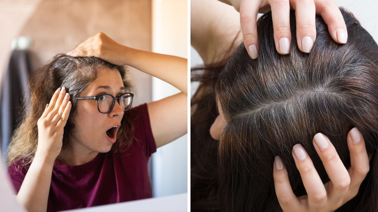 Why young people are getting grey hair earlier than ever