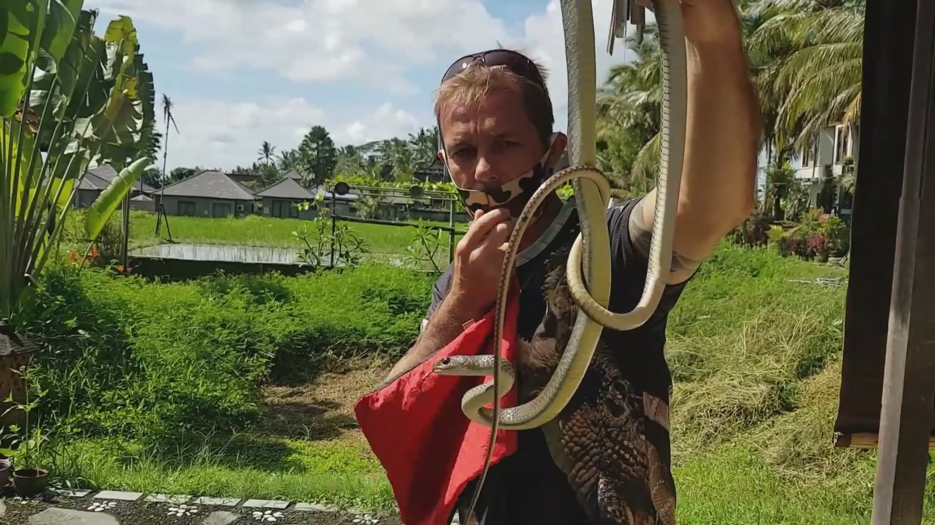 Critical snake bite warning signs