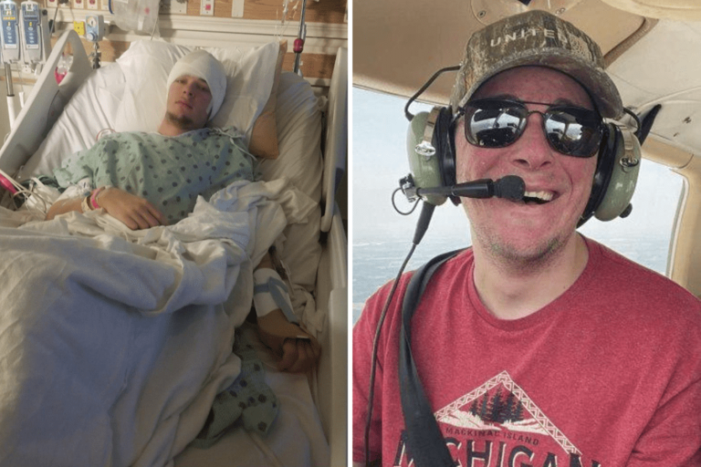 I had a seizure at 23—then surgeons removed a third of my brain
