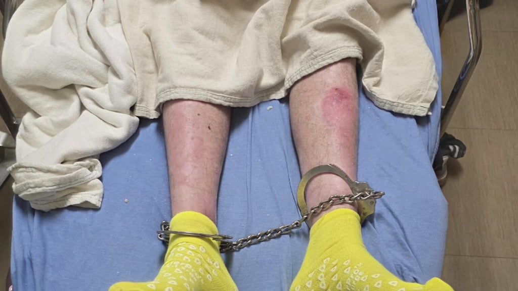 Libyan man in Minnesota for medical treatment for rare skin condition ...